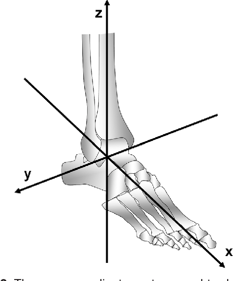 Figure 1 From Three Dimensional Analysis Of Ankle Instability After