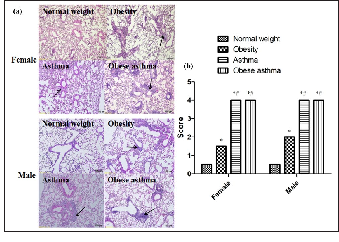 Figure 1 From Influence Of Gender On Ova Induced Airway Inflammation In