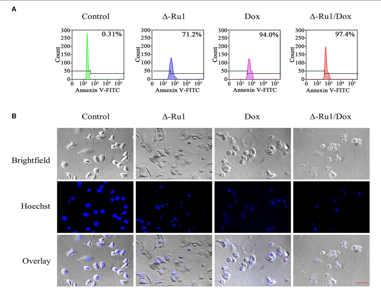 Figure 1 From Combination Of Ruthenium Complex And Doxorubicin