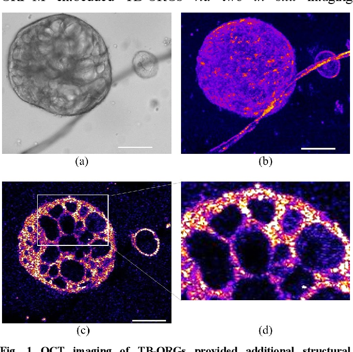 Figure 1 From Ultra High Resolution 3d Optical Coherence Tomography