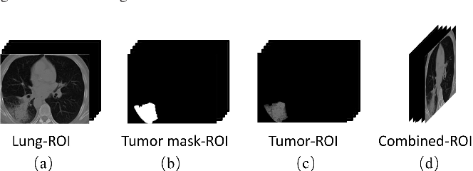 Figure 1 From A Novel Deep Learning Framework Based Mask Guided