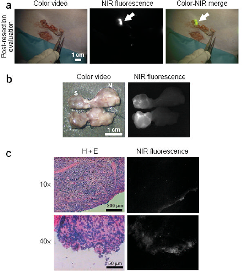 Sentinel Lymph Node Mapping Semantic Scholar