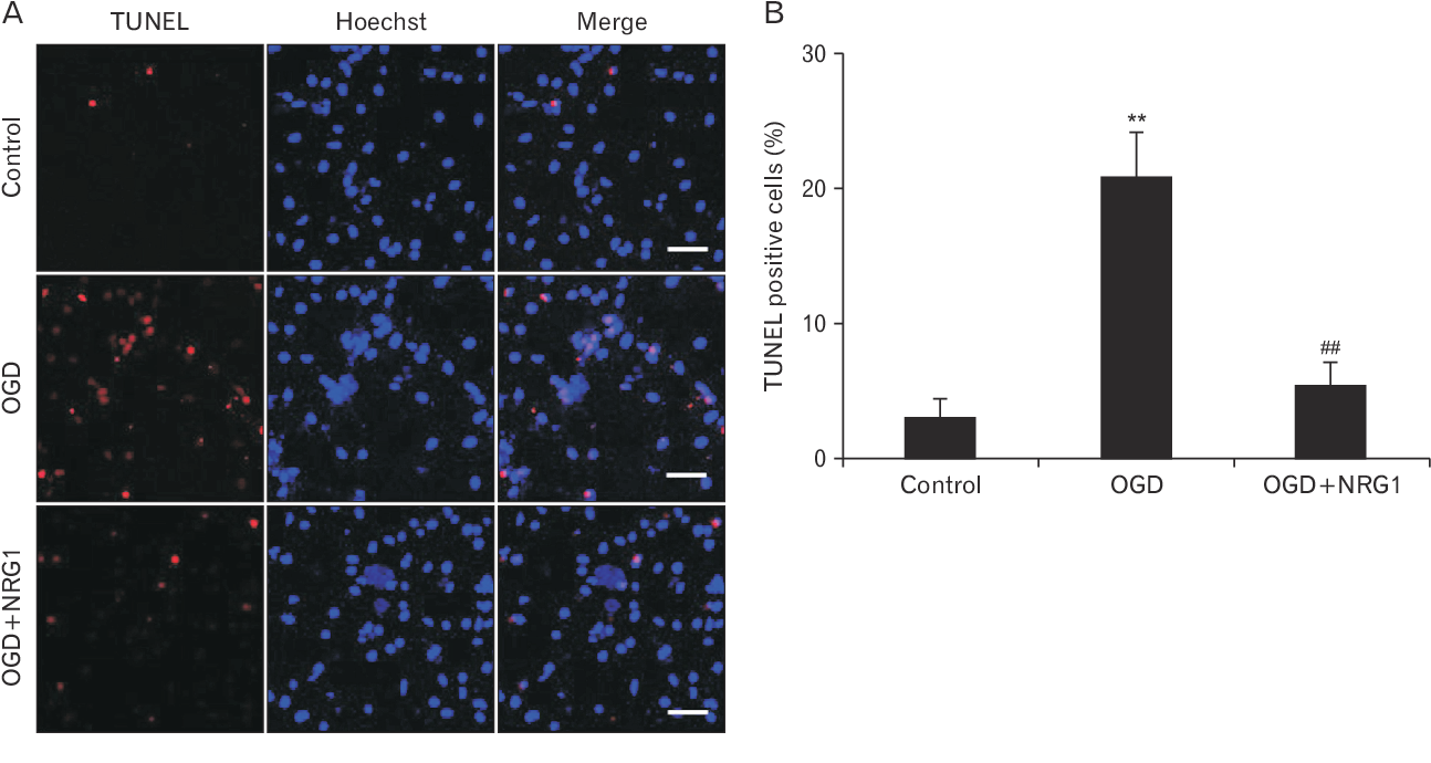 Pdf Neuregulin 1erbb4 Signaling Attenuates Neuronal Cell Damage