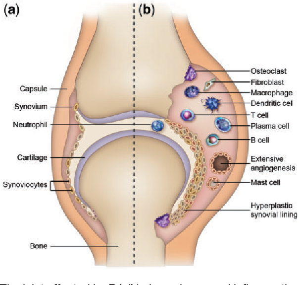 Understanding The Dynamics Pathways Involved In The Pathogenesis Of