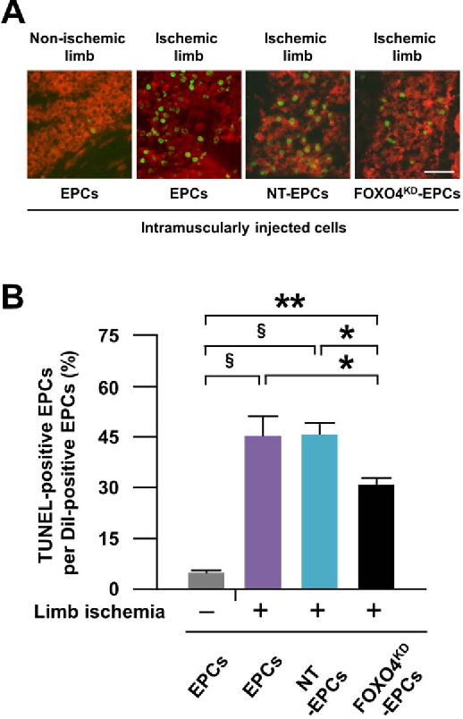 Figure 1 From Foxo4 Knockdown Suppresses Oxidative Stress Induced