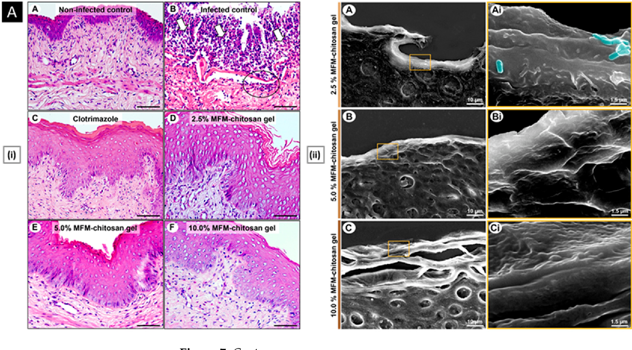 Pdf Chitosan A Potential Biopolymer In Drug Delivery And Biomedical