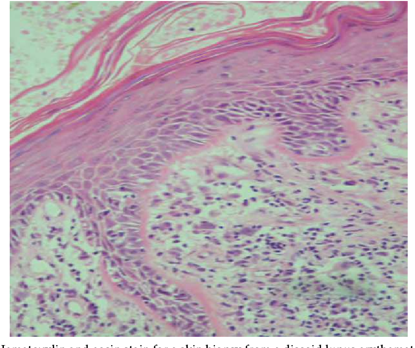 Figure 1 From General Methods In Preparation Of Skin Biopsies For