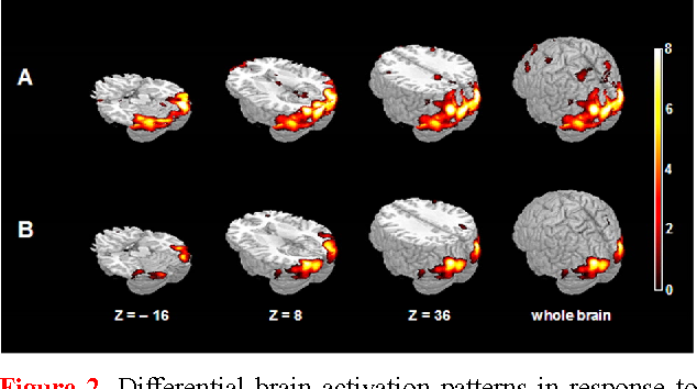 Figure 2 From Brain Activation Patterns Associated With Sexual