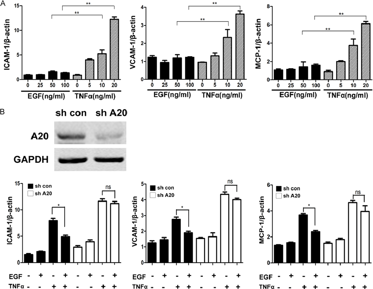 Figure 1 From Epidermal Growth Factor Upregulates The Expression Of A20