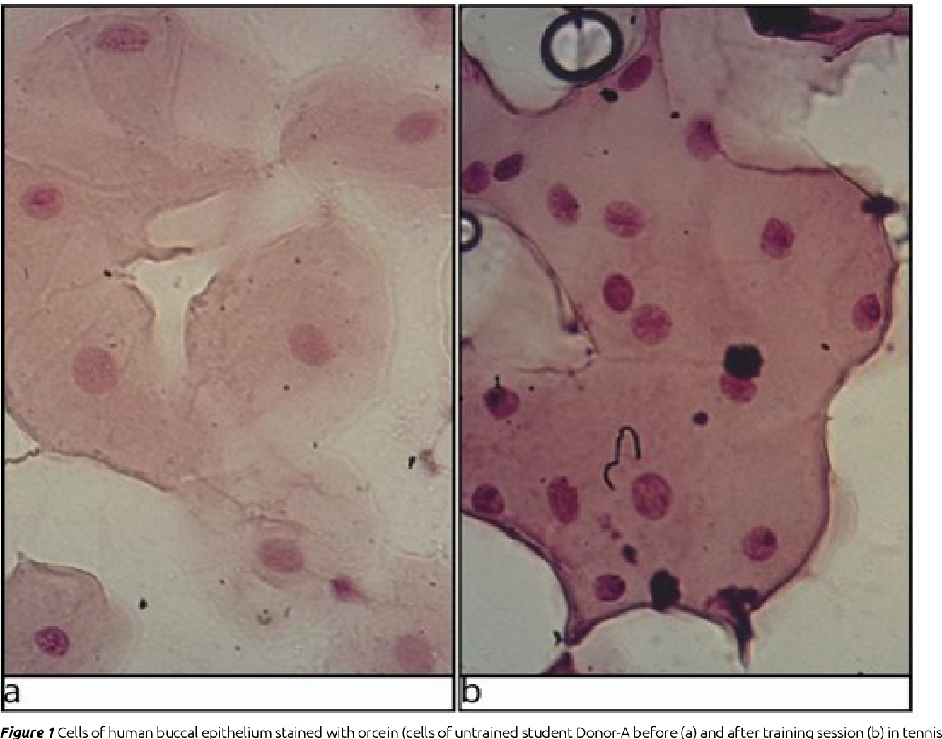 Figure 1 From Condensation Of Chromatin In Human Buccal Epithelium