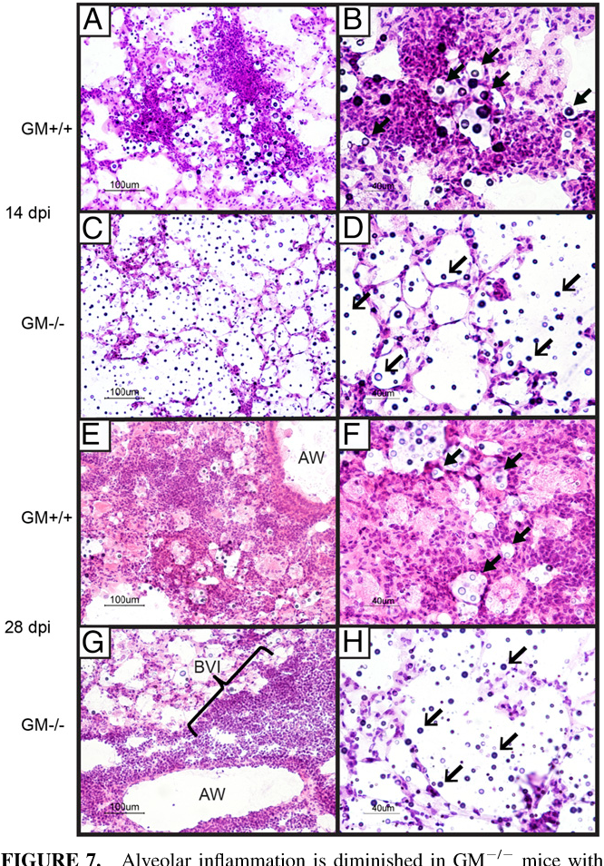 Figure 6 From Cryptococcal Lung Infection In Mice And Macrophages