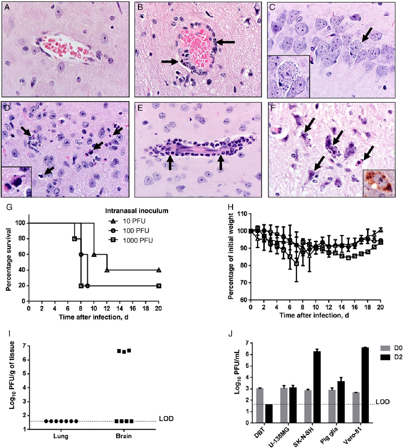 Pdf Middle East Respiratory Syndrome Coronavirus Causes Multiple