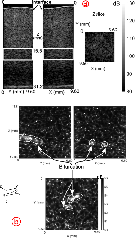 Figure 1 From Ultrafast 3d Ultrasound Localization Microscopy Using A