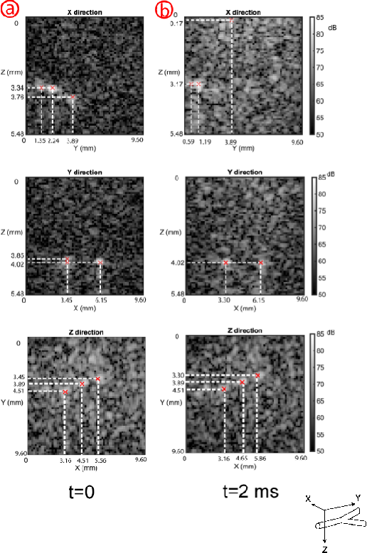 Figure 1 From Ultrafast 3d Ultrasound Localization Microscopy Using A