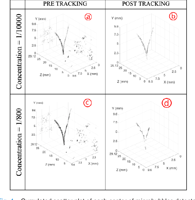 Figure 1 From Ultrafast 3d Ultrasound Localization Microscopy Using A