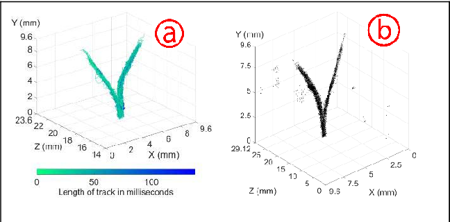 Figure 1 From Ultrafast 3d Ultrasound Localization Microscopy Using A