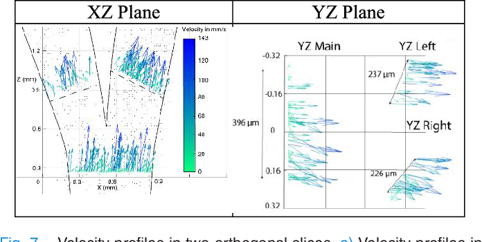 Figure 1 From Ultrafast 3d Ultrasound Localization Microscopy Using A