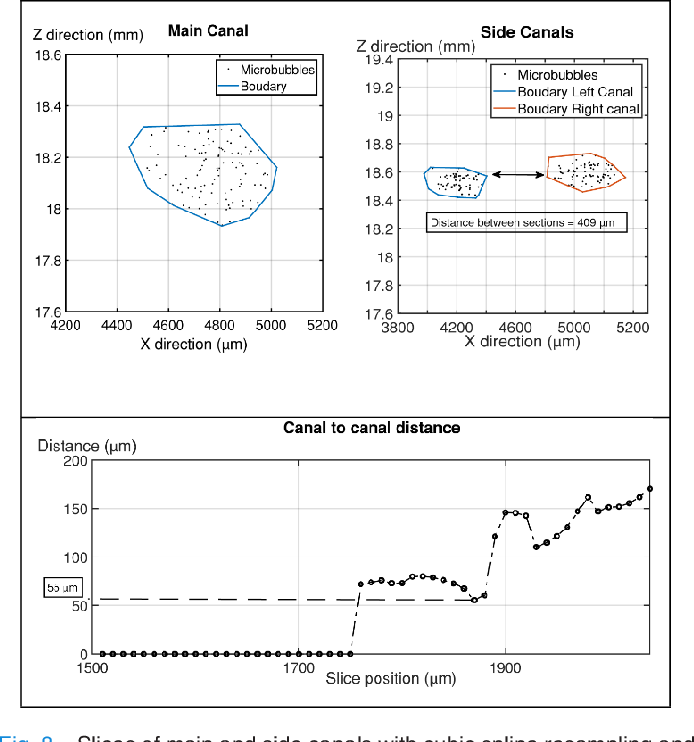 Figure 1 From Ultrafast 3d Ultrasound Localization Microscopy Using A