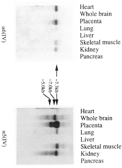 Complete Primary Structure Of The Sixth Chain Of Human Basement