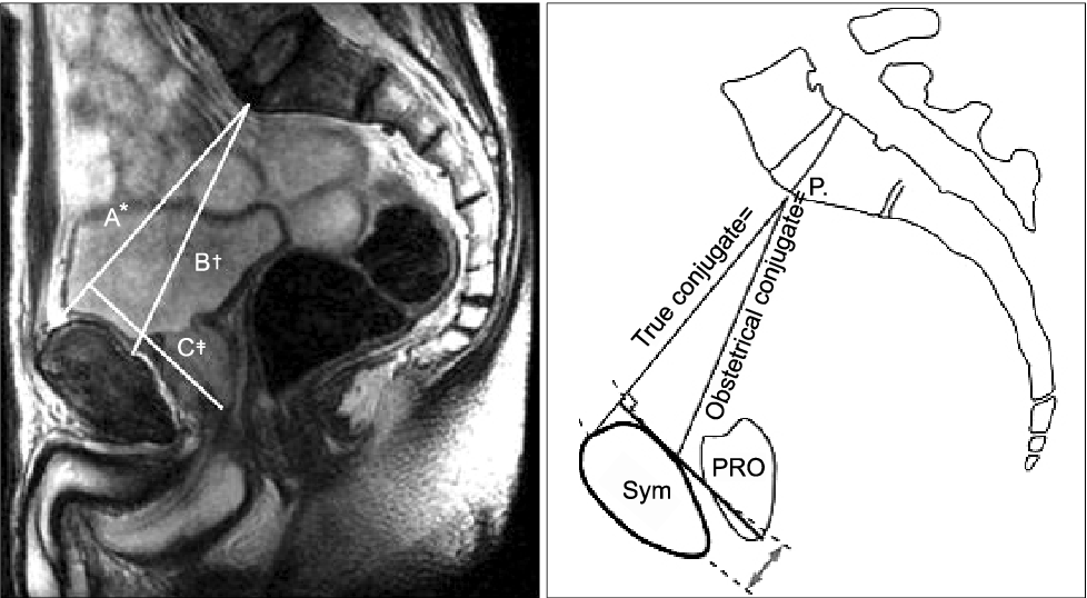 Figure 1 From The Factor Affecting Radical Retropubic Prostatectomy