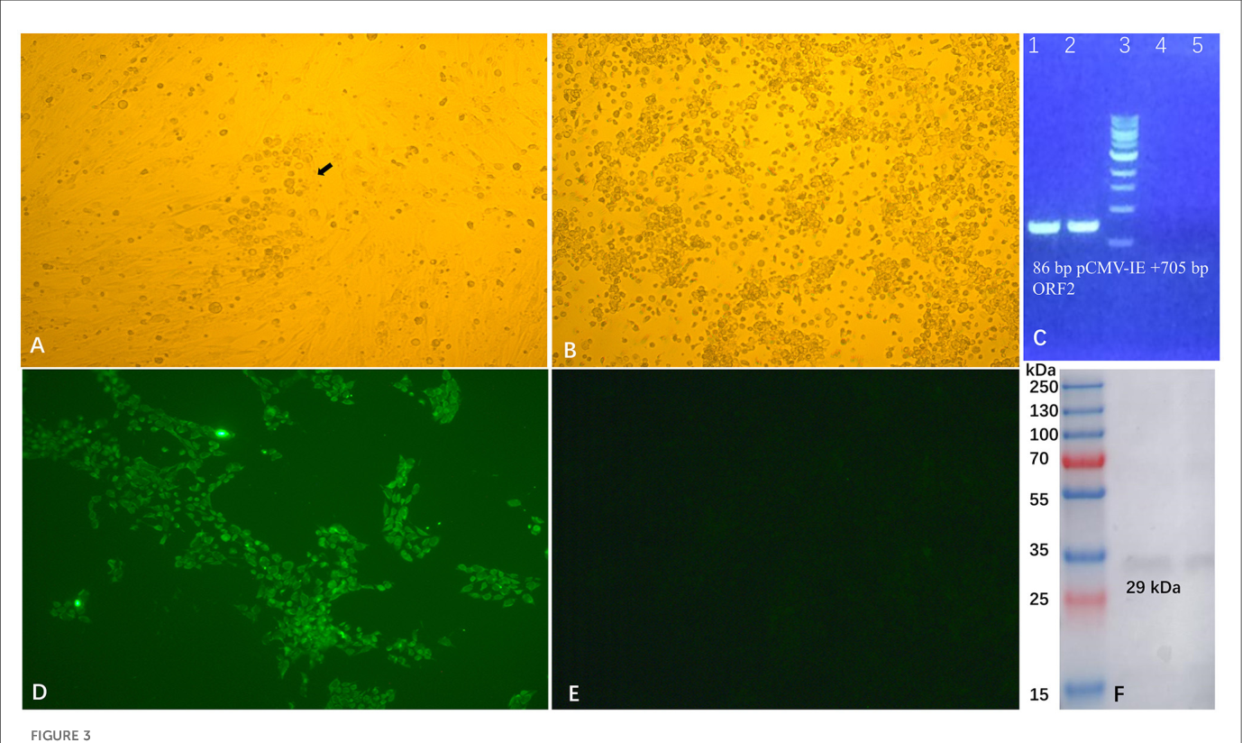 An Easy Method To Generate Recombinant Pseudorabies Virus Expressing