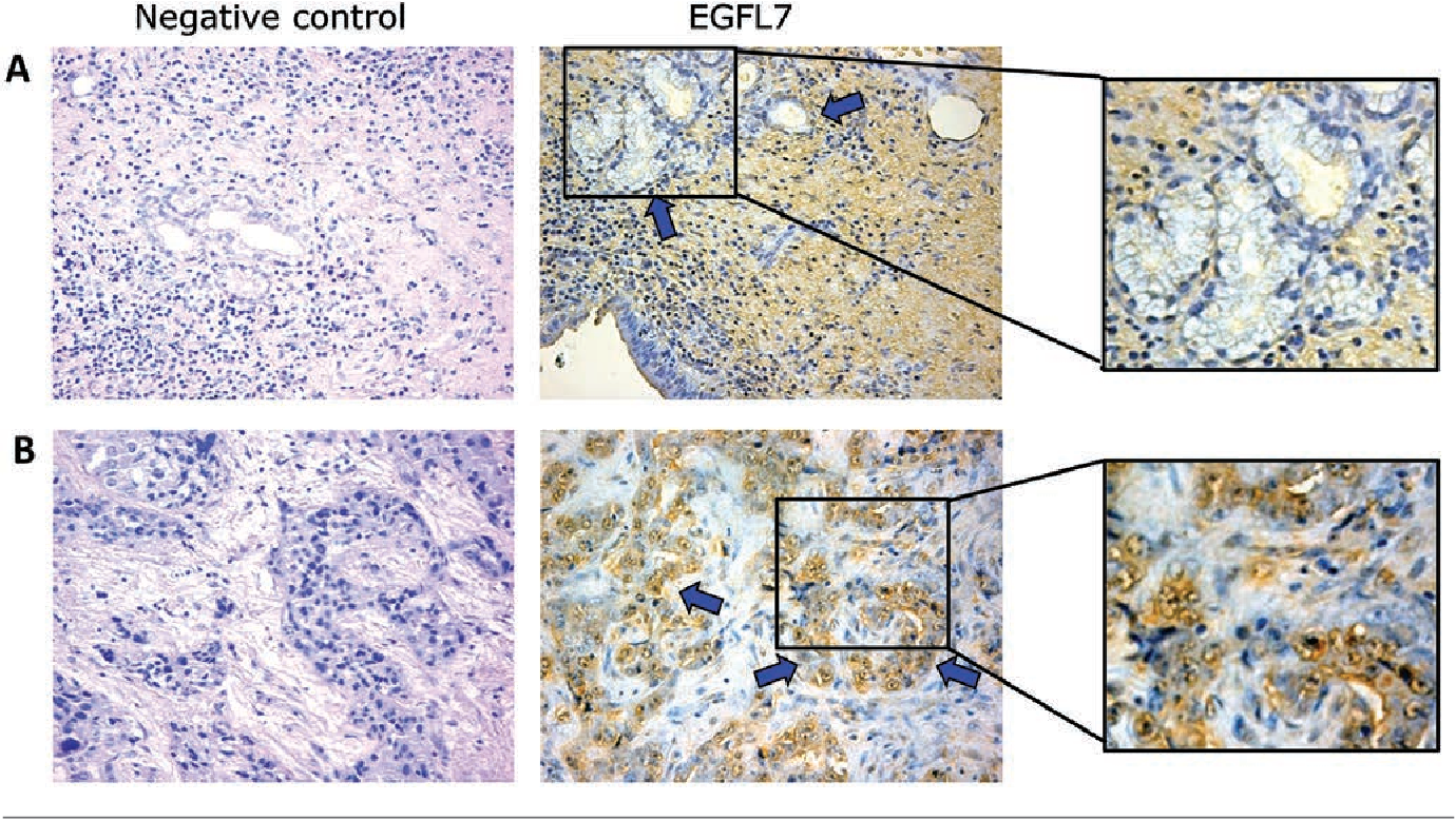 Figure 1 From Epidermal Growth Factor Like Domain Multiple 7 Egfl7