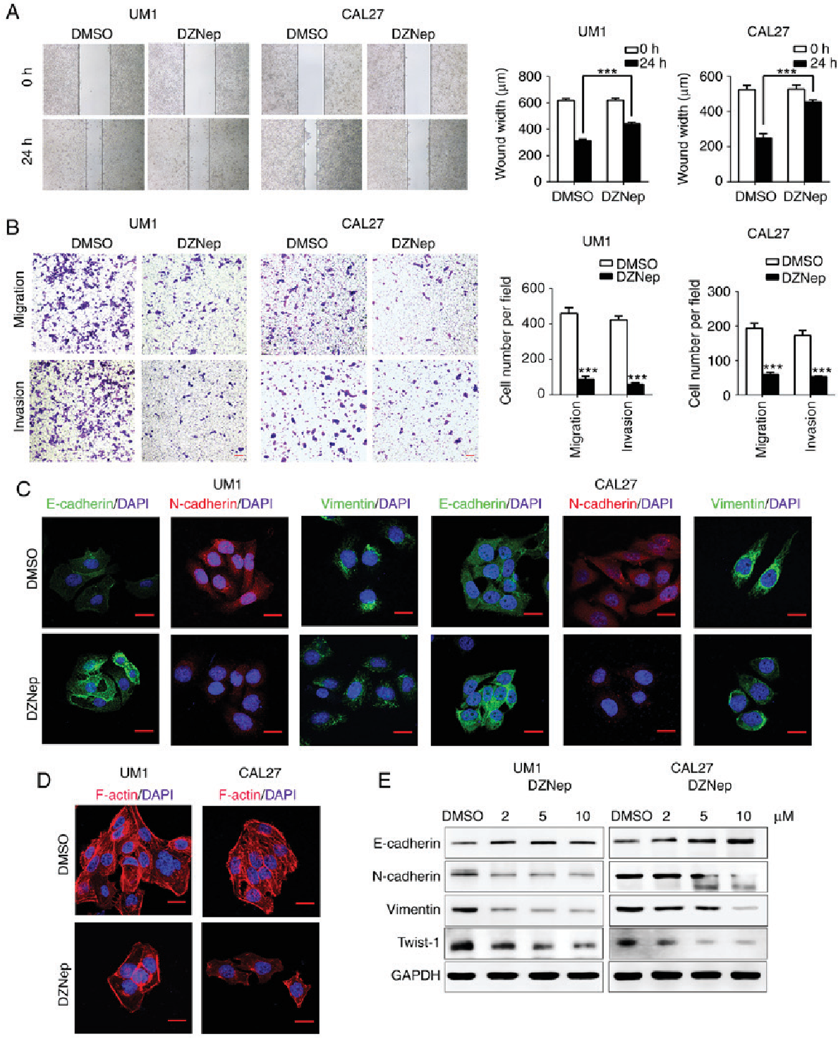 Figure 1 From Targeting Of Ezh2 Inhibits Epithelial‑mesenchymal