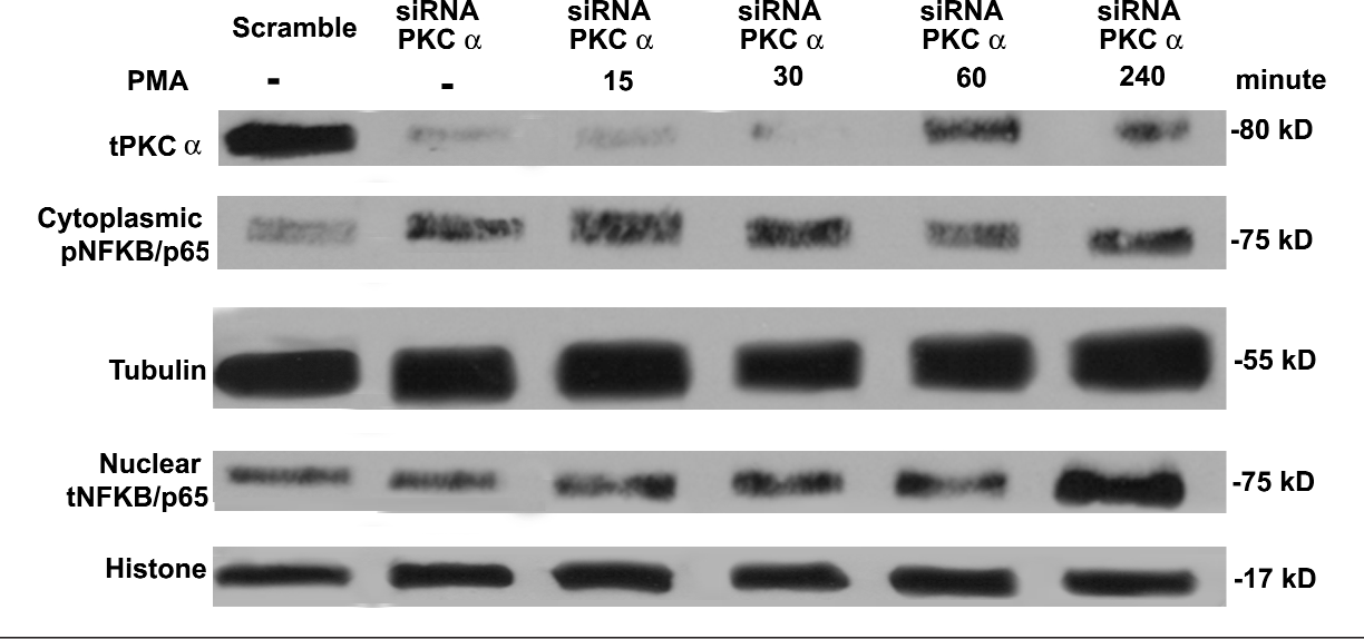 Figure 1 From Pkc Alpha Phosphorylates Cytosolic Nf Kappabp65 And Pkc