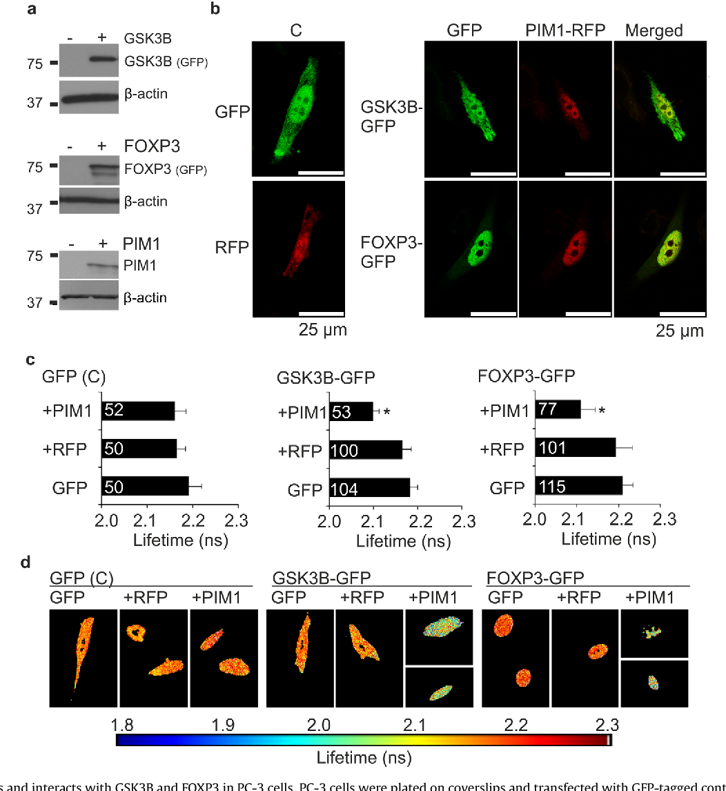 Figure 1 From The Pim1 Kinase Promotes Prostate Cancer Cell Migration