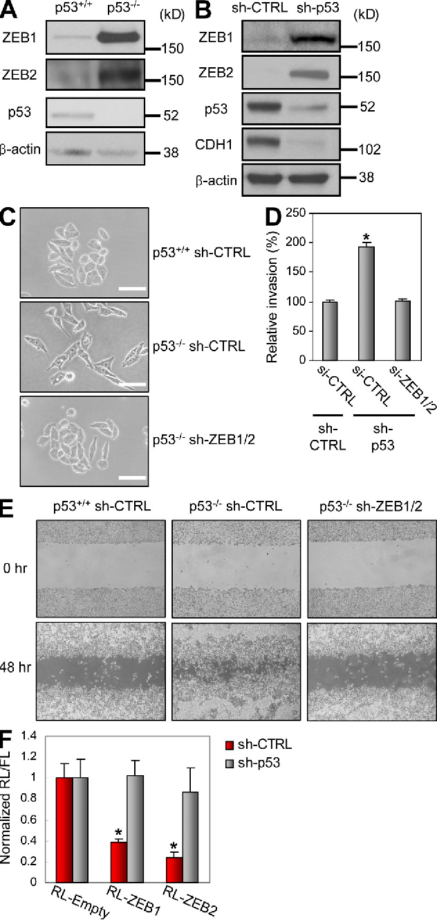 Figure 2 From P53 Regulates Epithelialmesenchymal Transition Through