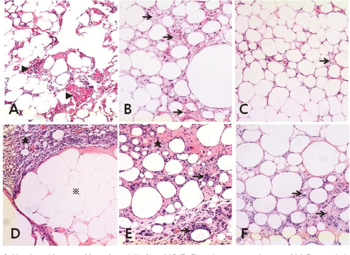 Adipose Tissue Histology