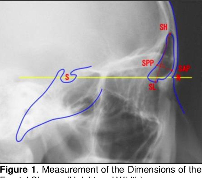 Figure 1 From Mapping Cervical Vertebral Maturation Levels With The