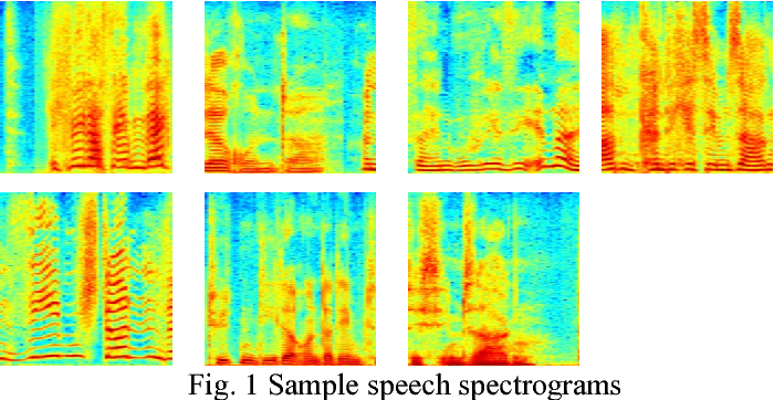 Speech Emotion Recognition From Spectrograms With Deep Convolutional