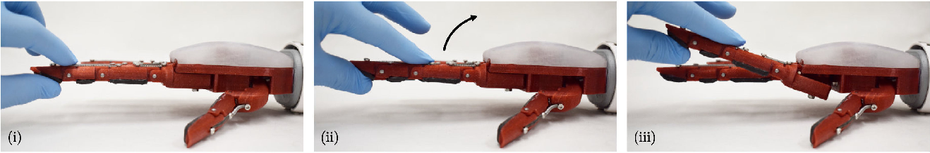 Figure 1 From Olympic A Modular Tendon Driven Prosthetic Hand With