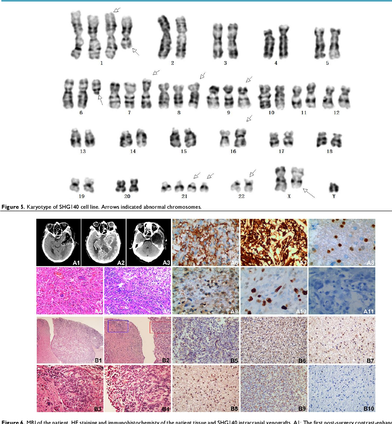 Pdf Characterization Of A New Human Astrocytoma Cell Line Shg140