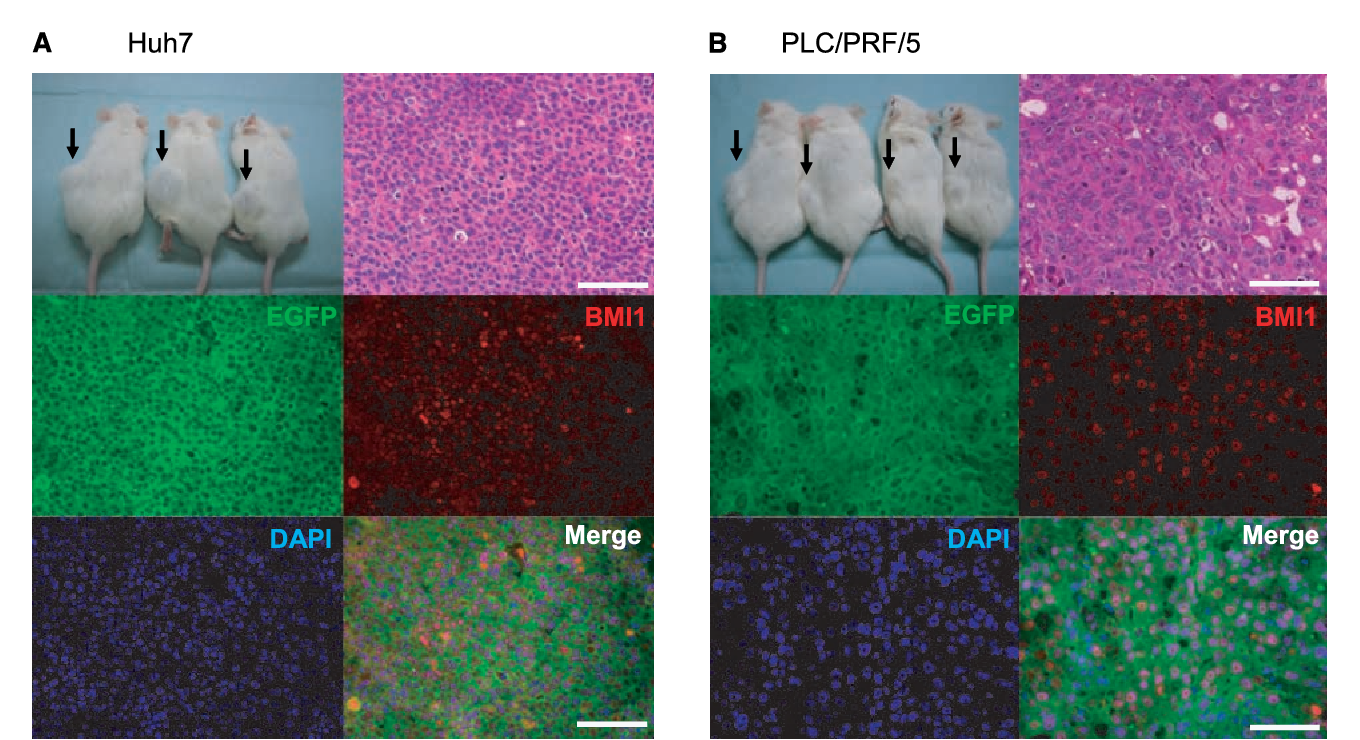 Figure 1 From The Polycomb Gene Product Bmi1 Contributes To The