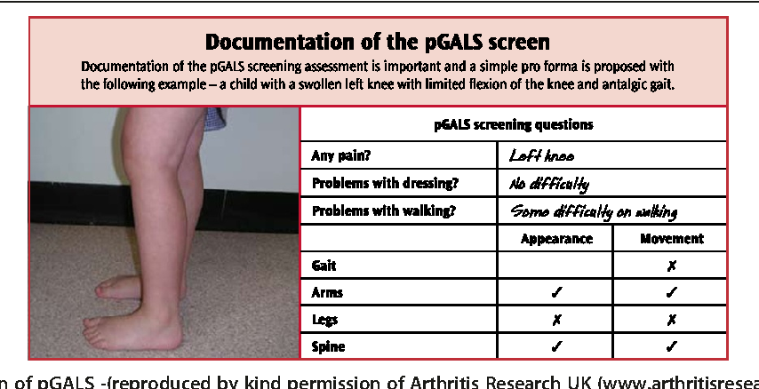 Pdf Pgals Paediatric Gait Arms Legs And Spine A Simple Examination
