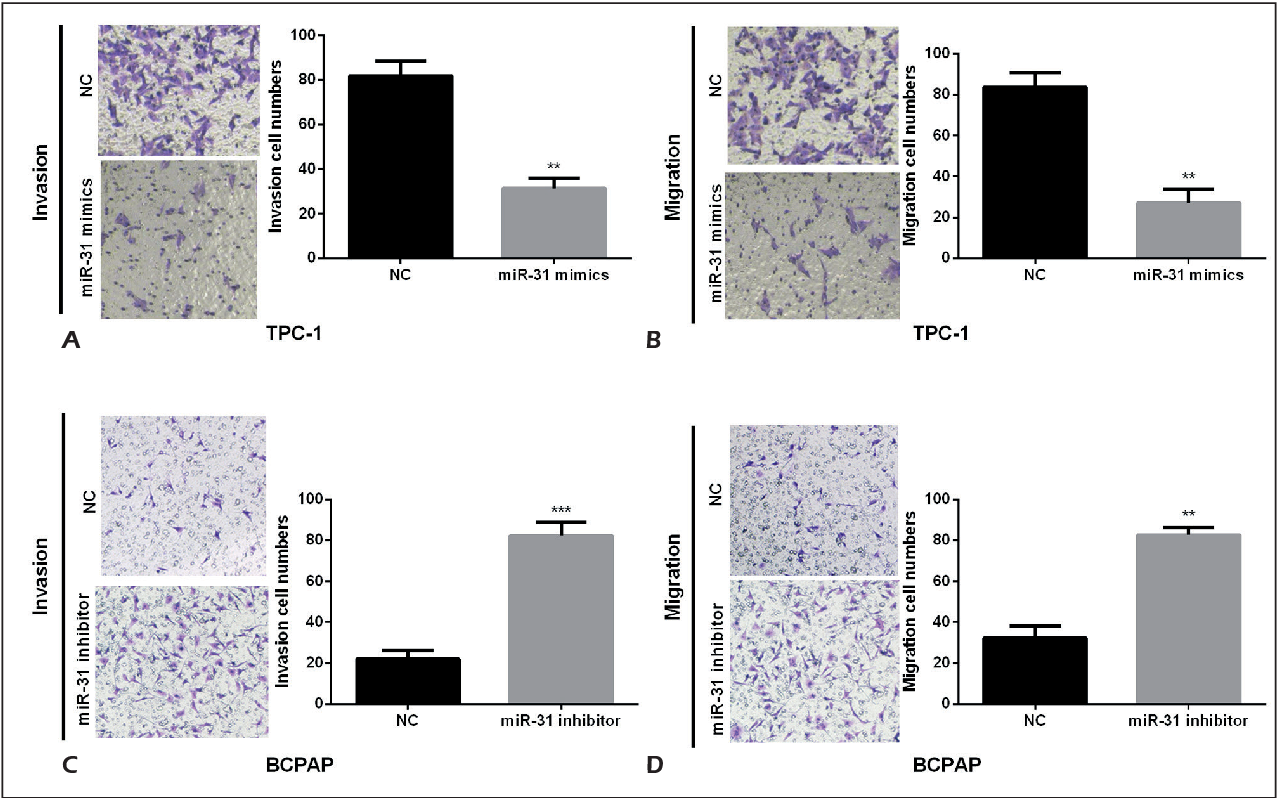 Figure 1 From Microrna 31 Inhibits Papillary Thyroid Carcinoma Cell