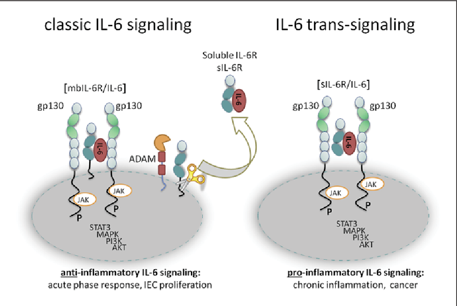 Figure 1 From Interleukin 6 Trans Signaling And Colonic Cancer