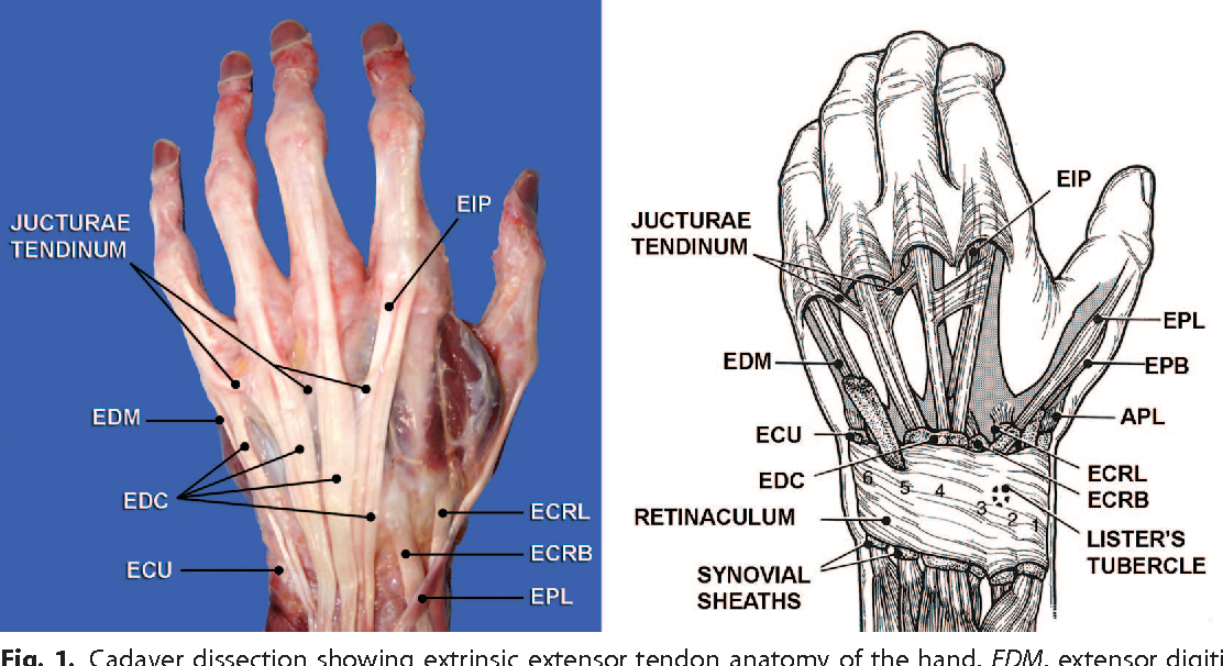 Extensor Tendons Hand Anatomy Anatomical Charts And Posters Porn Sex