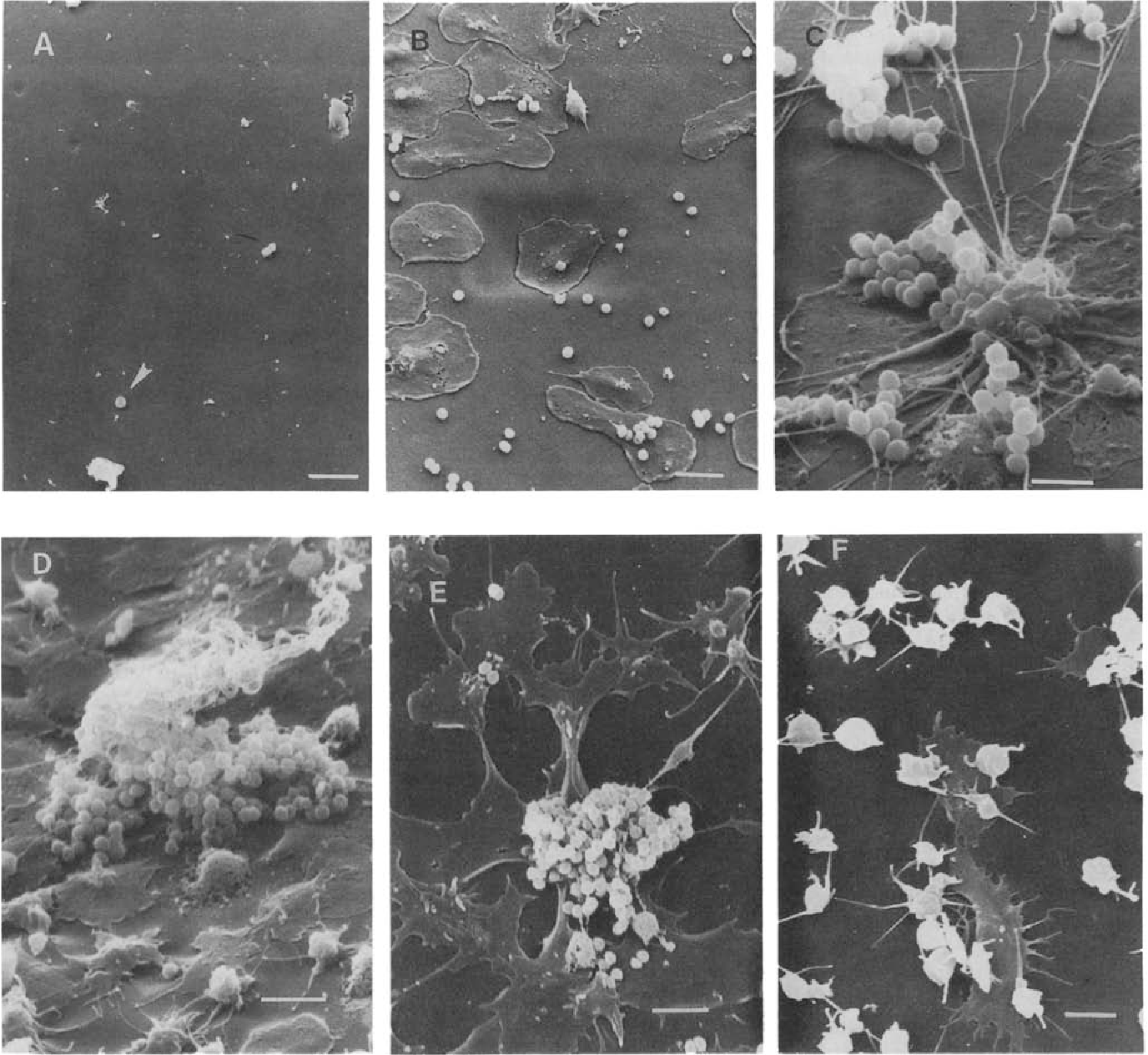 Figure 1 From Adhesion Of Staphylococcus Aureus To Surface Bound