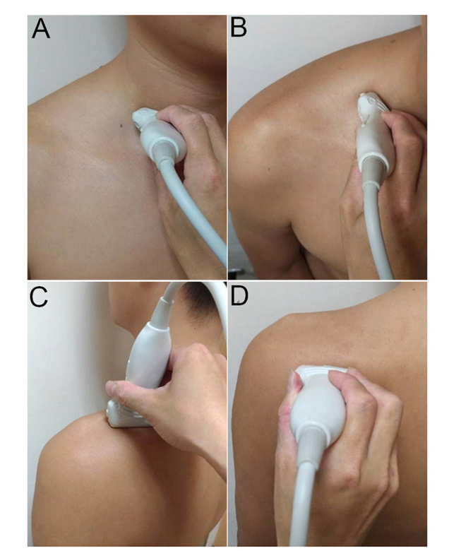 Figure 1 From Basis Of Shoulder Nerve Entrapment Syndrome An