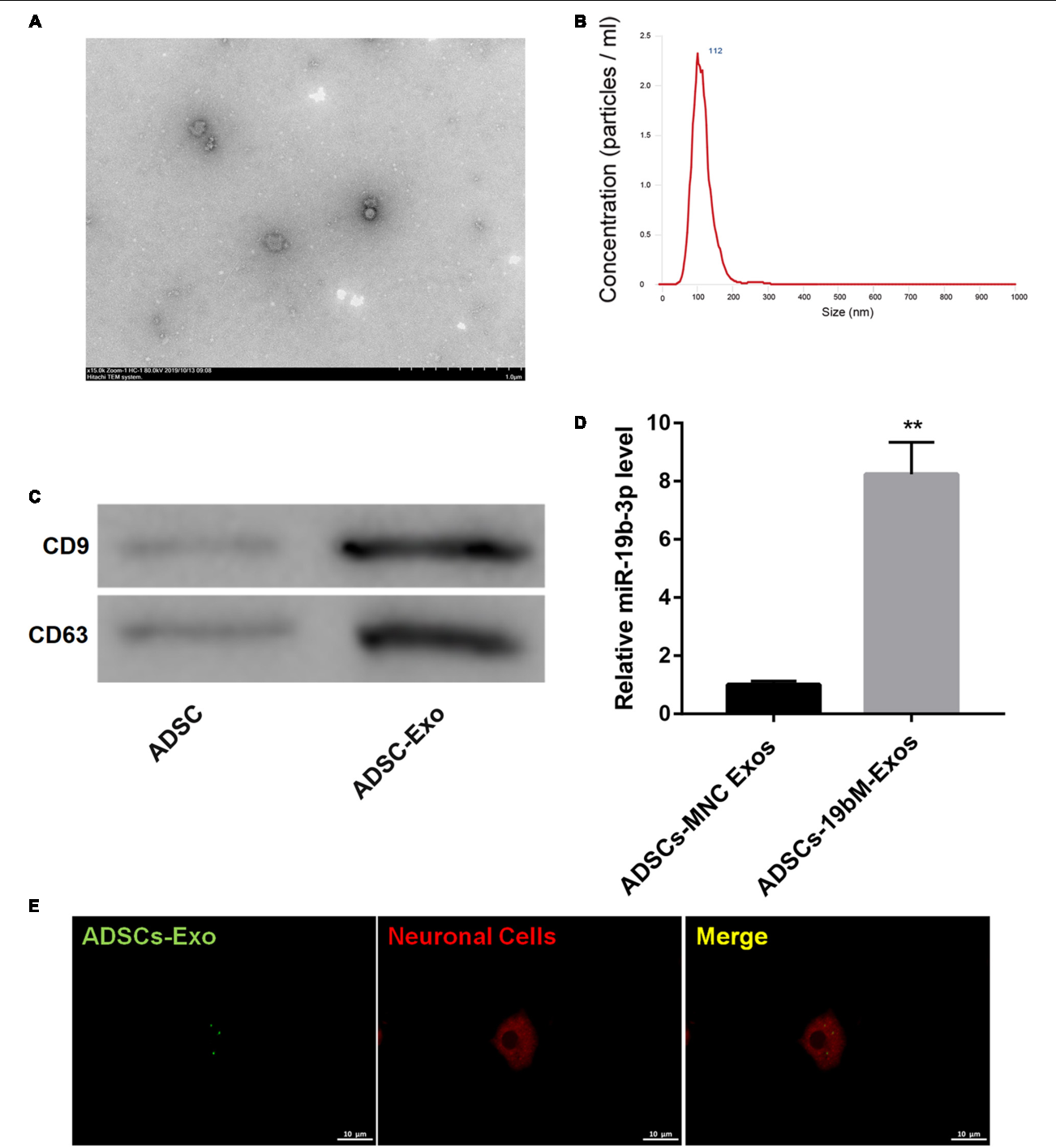 Exosomes From Mir 19b 3p Modified Adscs Inhibit Ferroptosis In