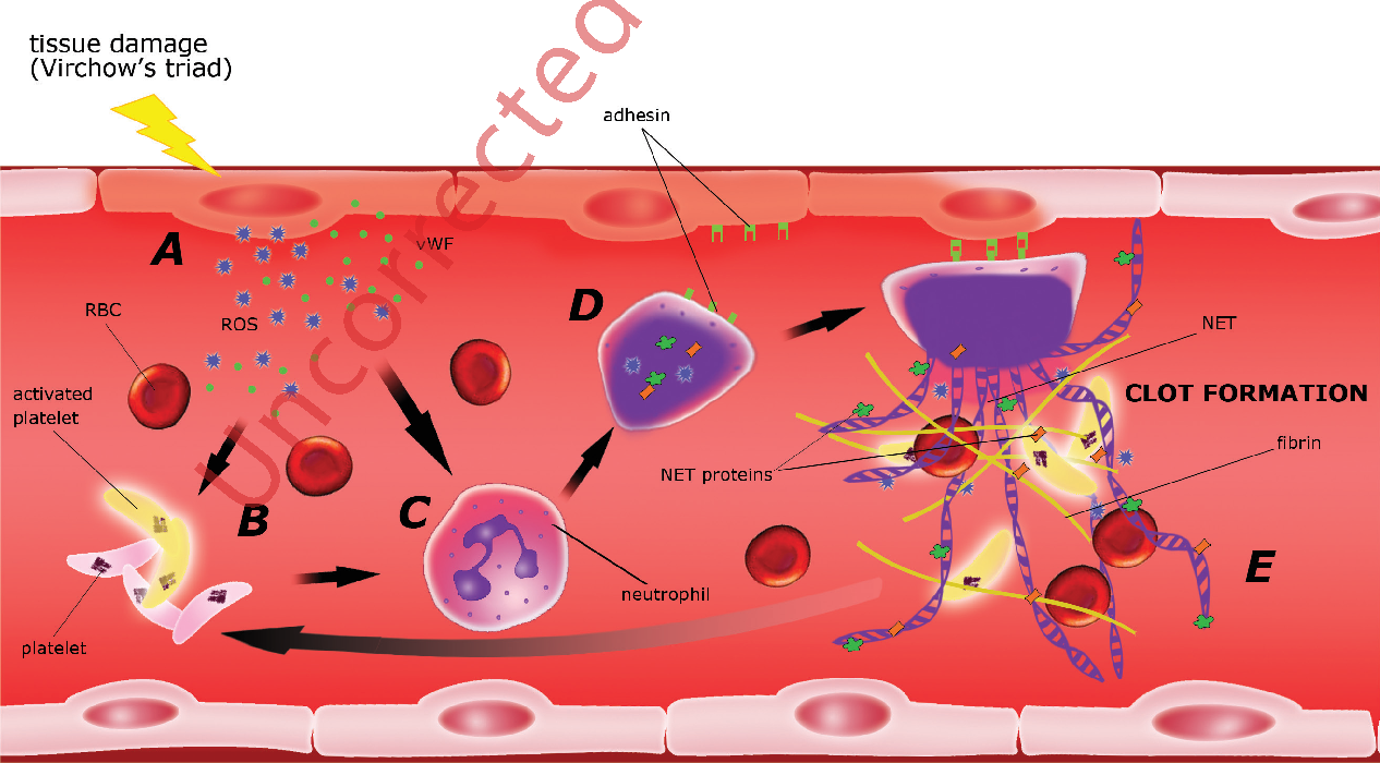 Neutrophil Extracellular Traps Nets — Formation And Implications