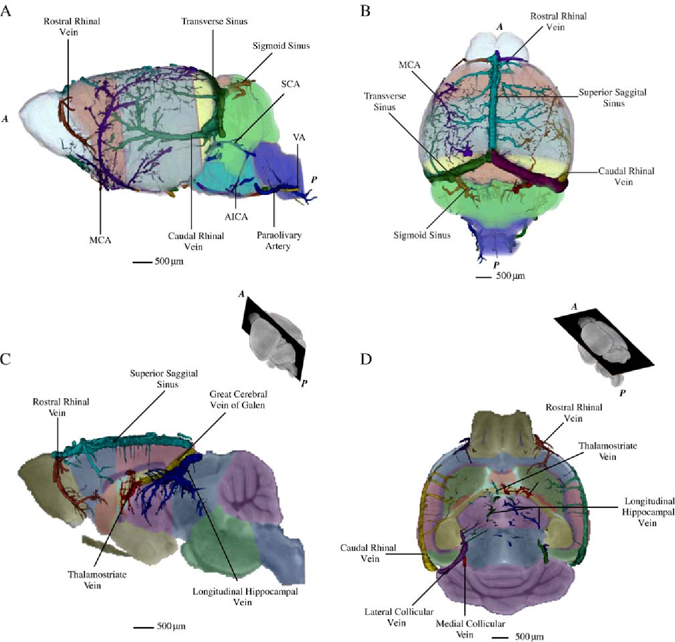 Figure 1 From Three Dimensional Cerebral Vasculature Of The Cba Mouse