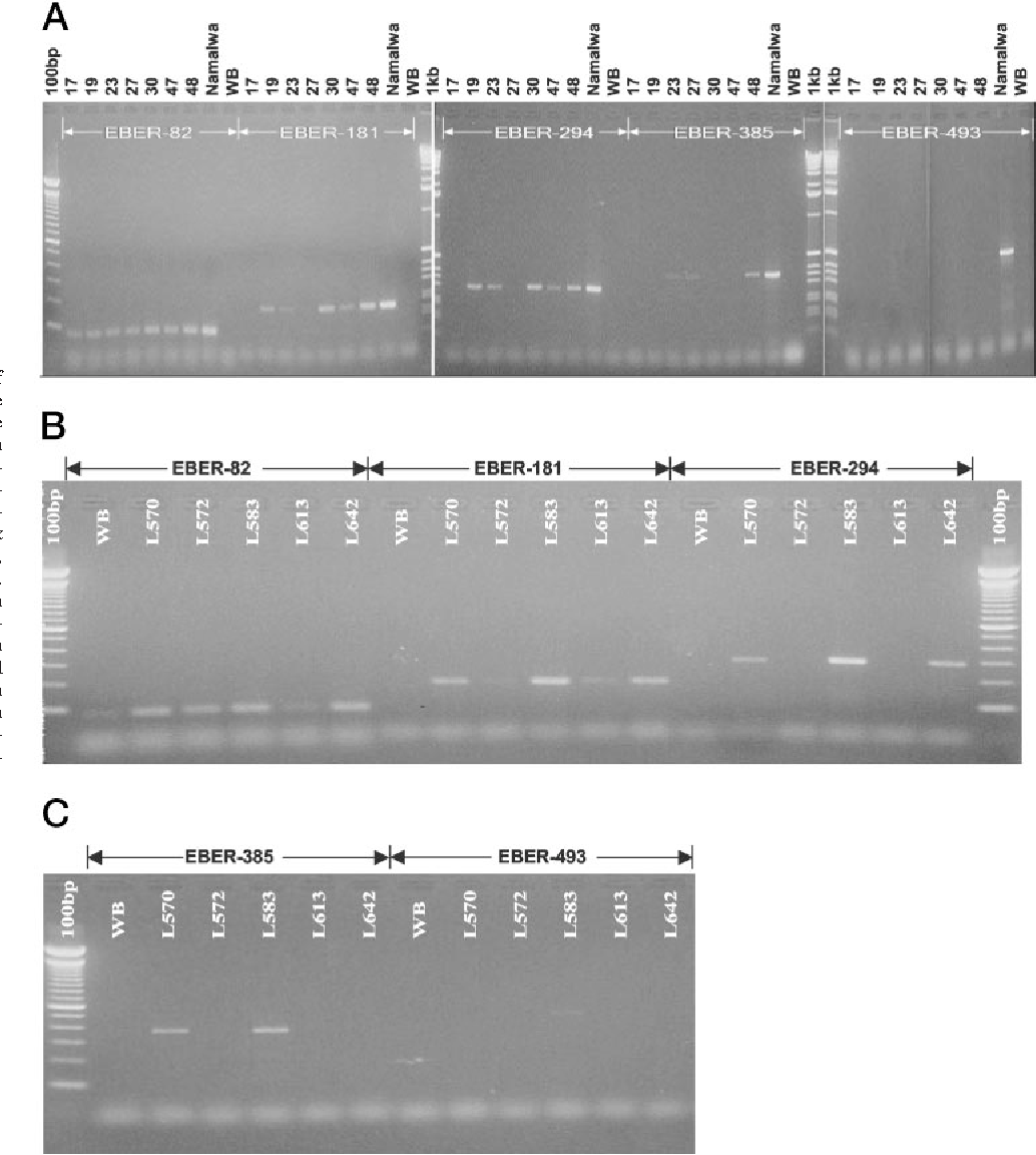 Figure 1 From Molecular Characterization Of Circulating Ebv Dna In The