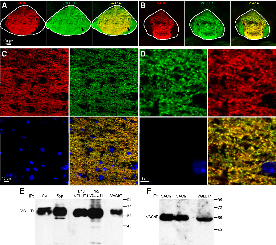 Figure 1 From Habenula Cholinergic Neurons Corelease Glutamate And