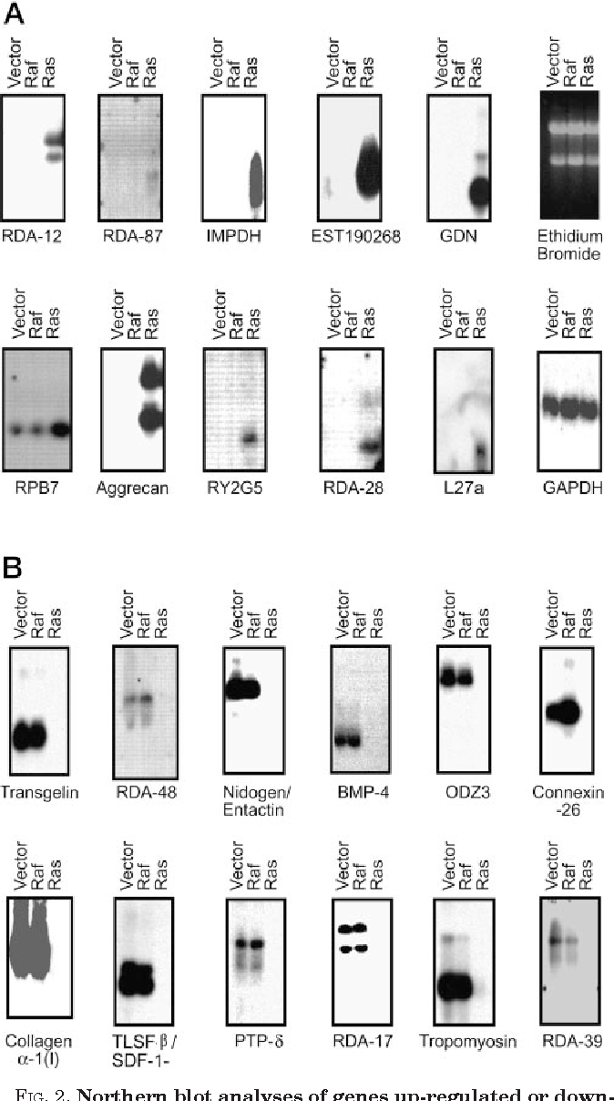 Pdf Loss Of Transgelin In Breast And Colon Tumors And In Rie 1 Cells