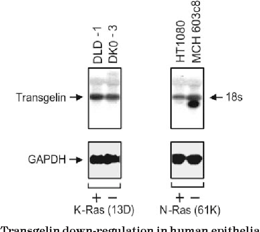 Figure 1 From Loss Of Transgelin In Breast And Colon Tumors And In Rie