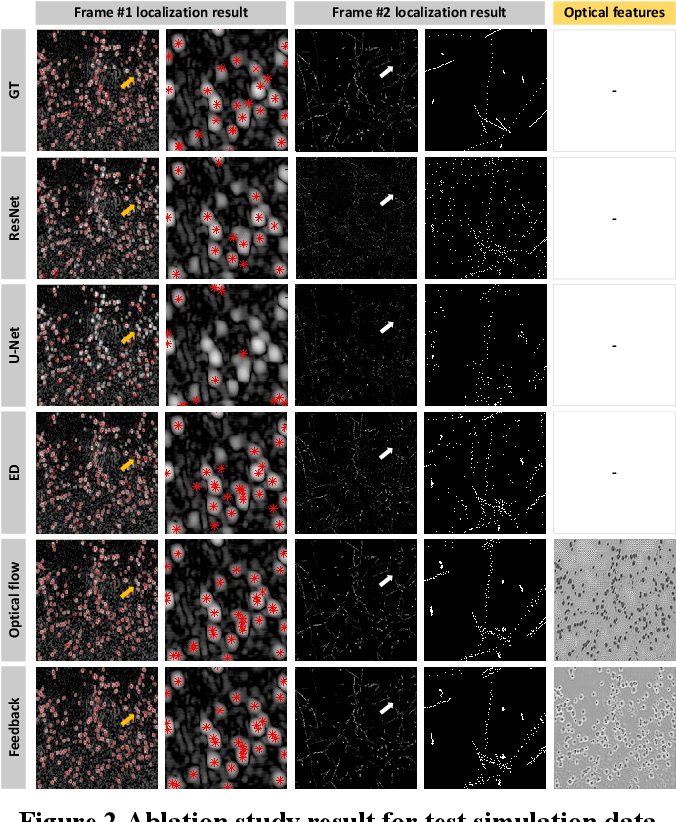 Figure 2 From Optical Flow Assisted Super Resolution Ultrasound